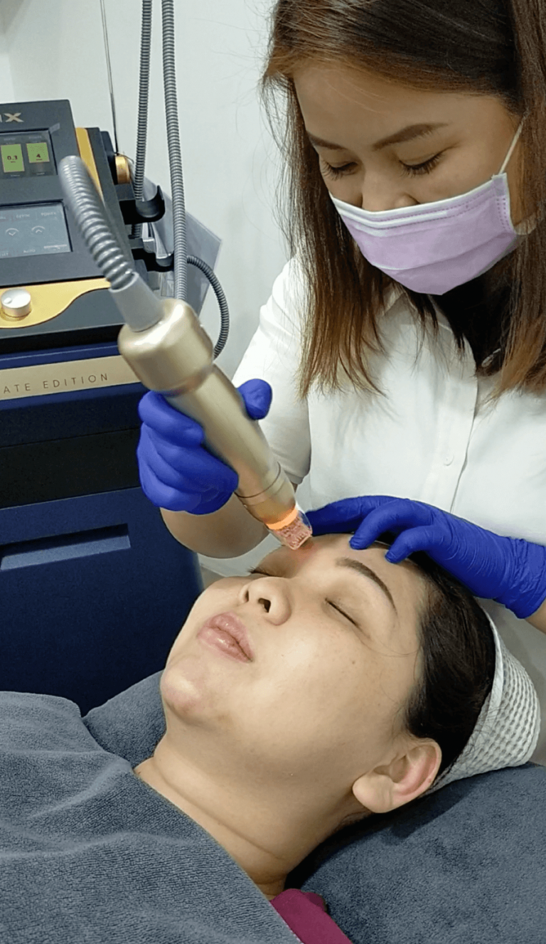 Microneedling Singapore | Gold Microneedling RF | Ageless Med